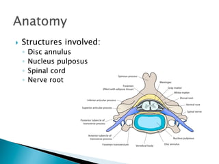 cervicalppt | PDF