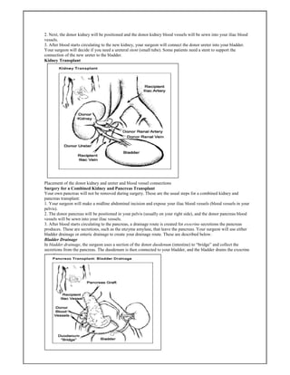 Guide- Kidney - Pancreas - Transplant | PDF