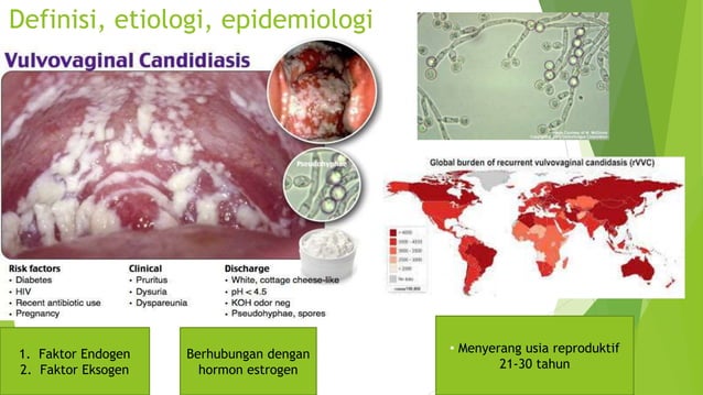 A8_Skenario 5_Pleno B15, candidiasis vulvovaginosa | PPT
