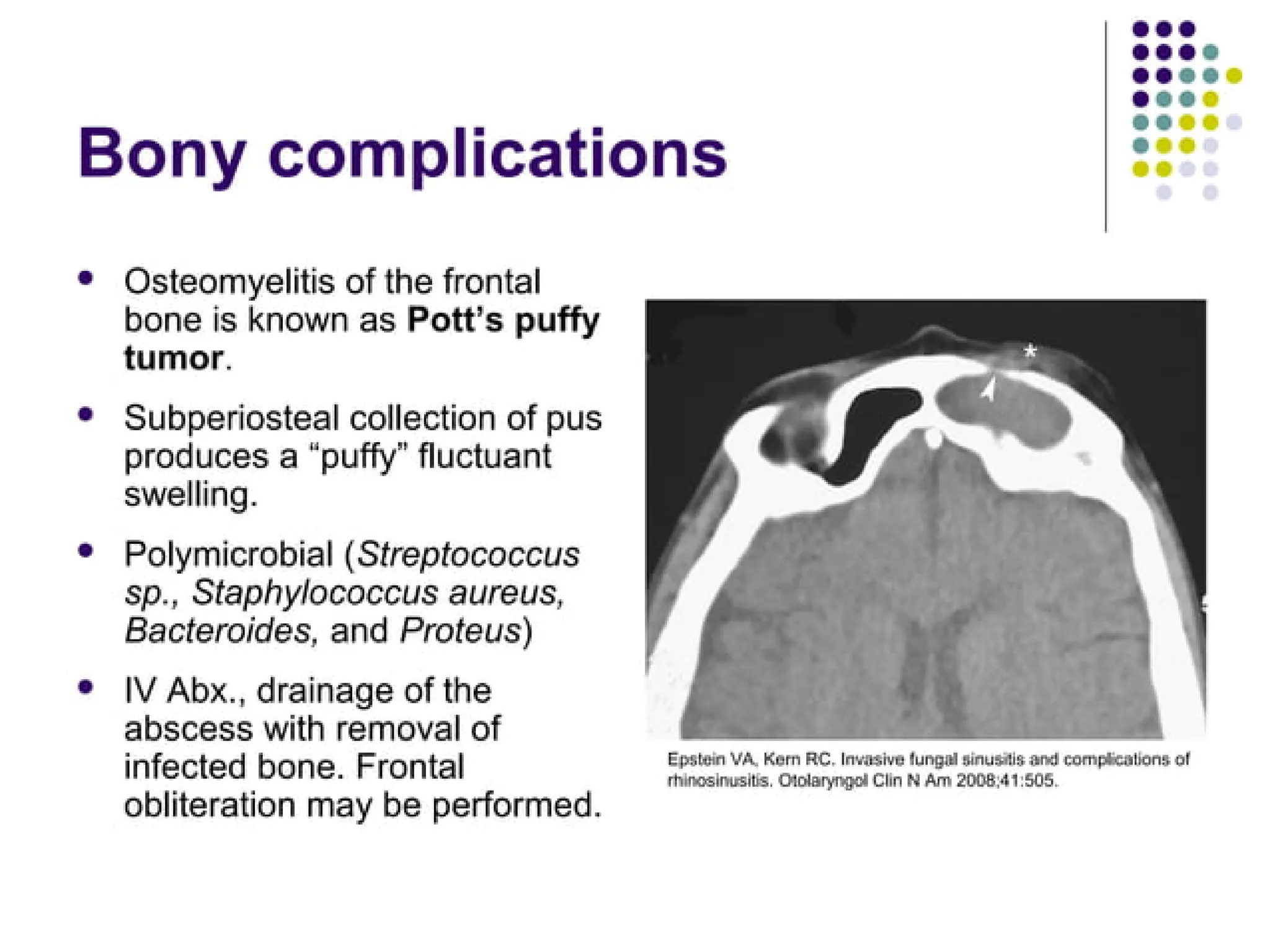 sinusitis rhinoghjvhjvjghgmhgvhhvghvhvhjv | PPT