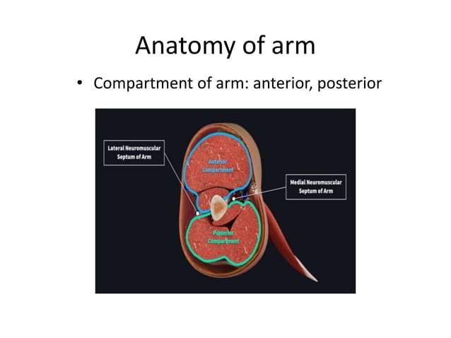 Compartment_Syndrome_CME-1.pptx