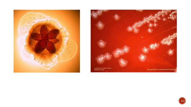 Aggregatibacter actinomycetemcomitans | PPTX | Oral care | Personal Care