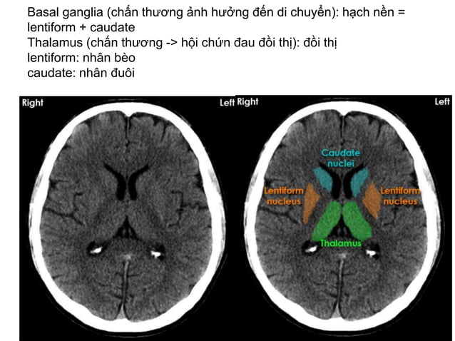 Thuật ngữ giải phẫu hệ thần kinh và ứng dụng CT | PPT