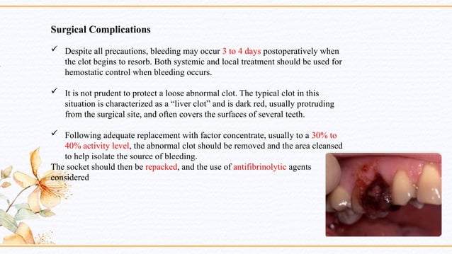 Management of medically compromised patients | PPT