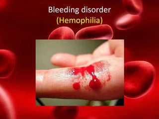 Blood hemostasis | PPTX