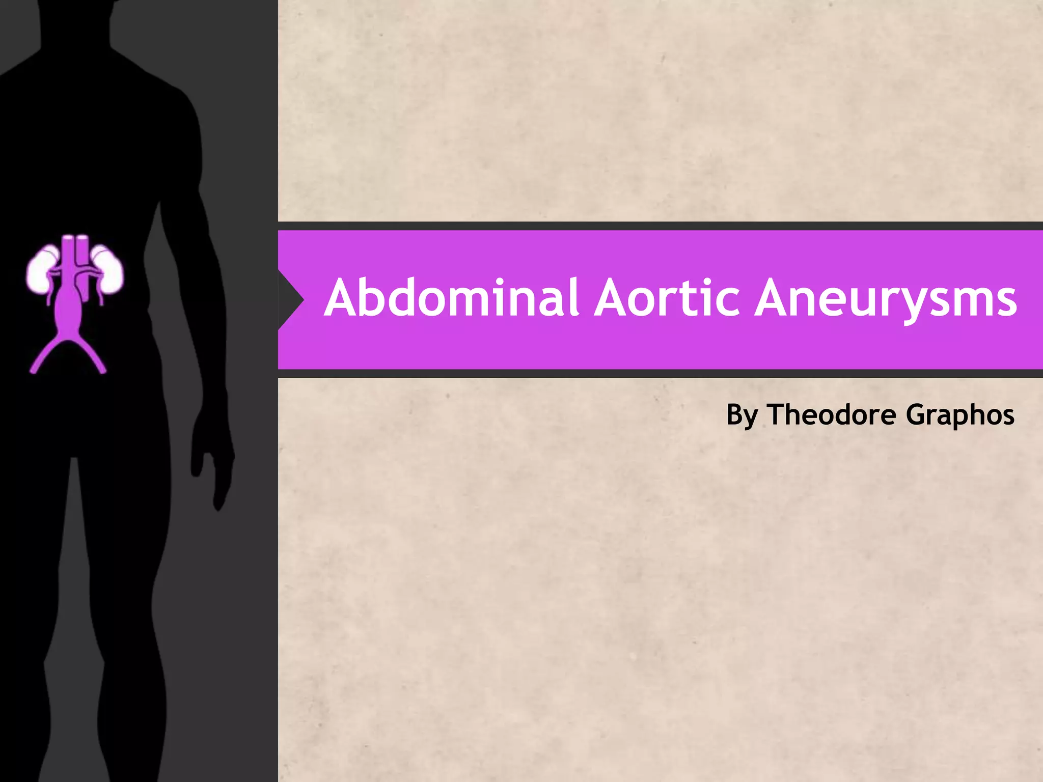 Abdominal Aortic Aneurysms | PPTX