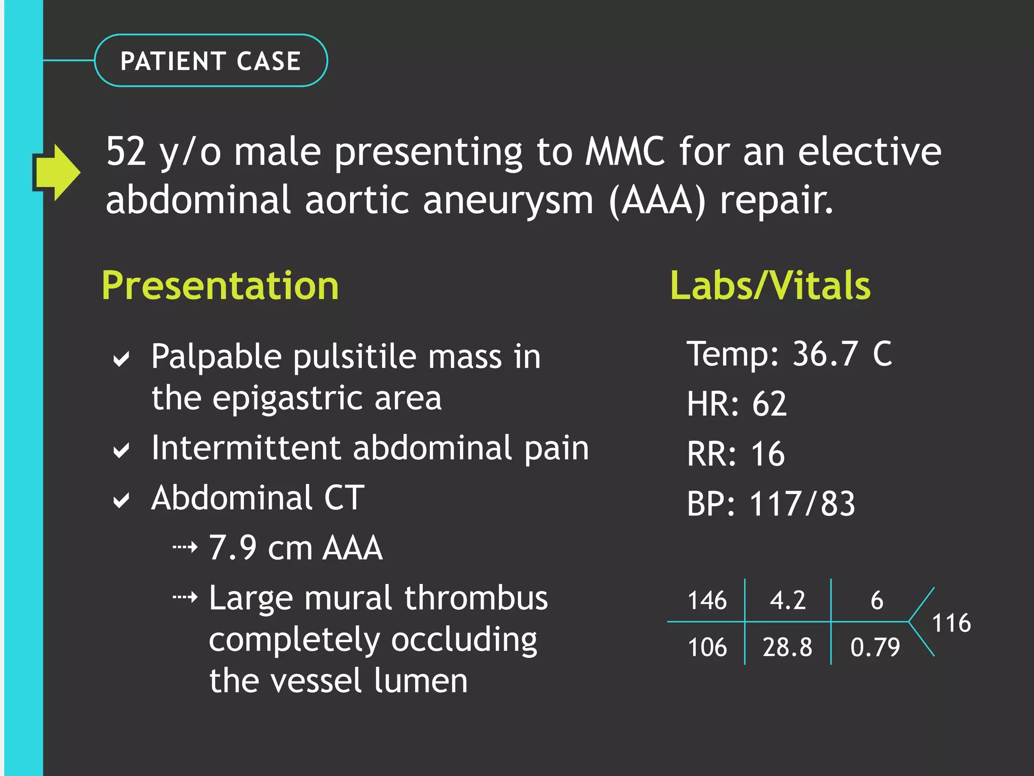 Abdominal Aortic Aneurysms | PPTX