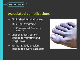Abdominal Aortic Aneurysms | PPTX