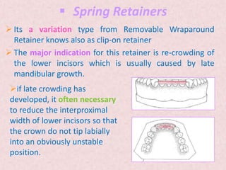 Retention and Relapse .. AAA | PPT