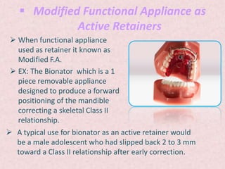 Retention and Relapse .. AAA | PPTX
