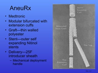 AAA.ppt Abdominal Aortic Aneurysms presentation | PPT