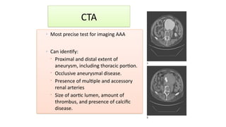 Abdominal aortic aneurysm vascular surgery | PPTX