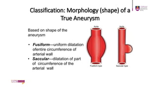 Abdominal Aortic Aneurysm | PPTX
