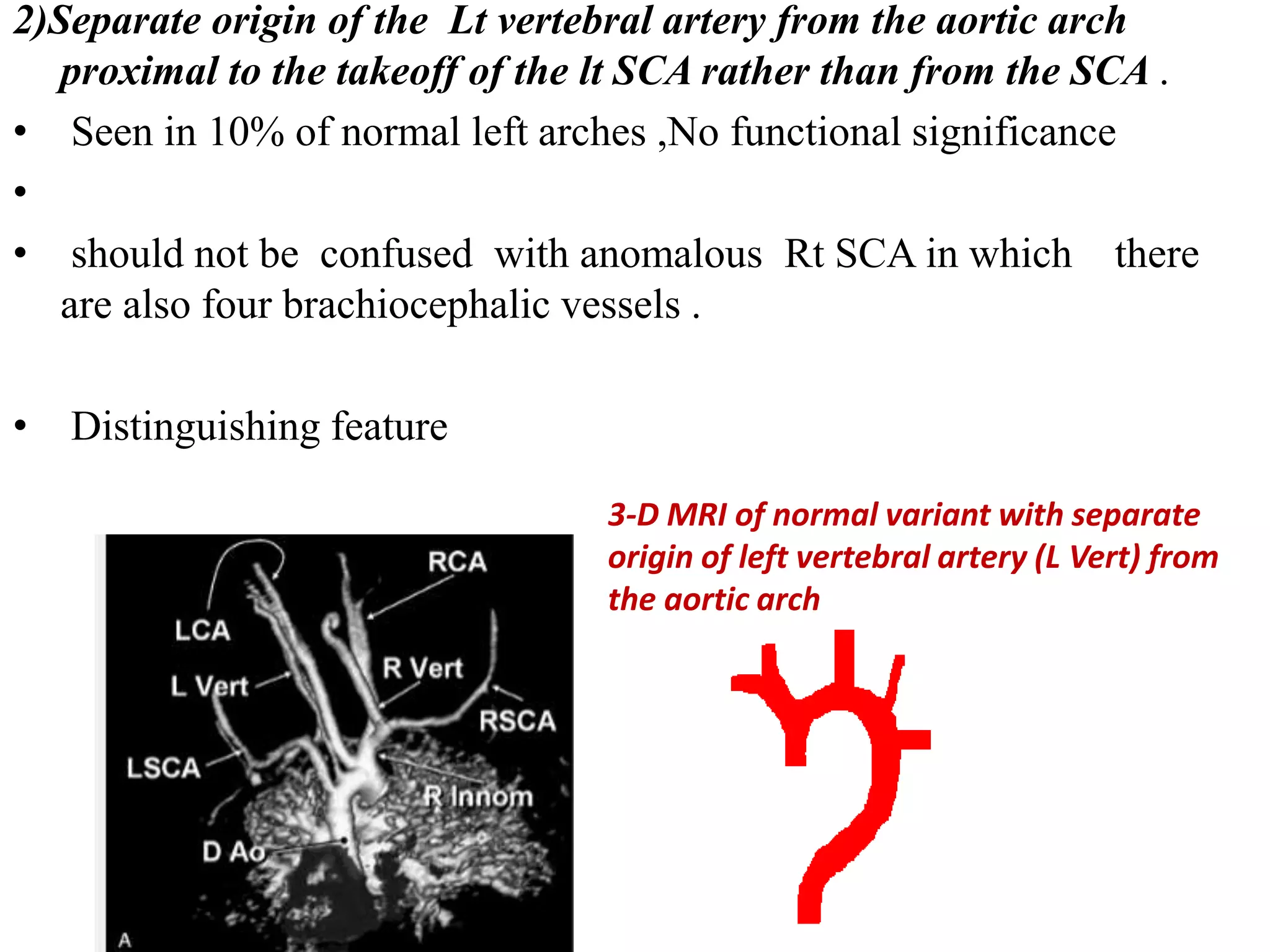 aortic arch anamolies | PPTX