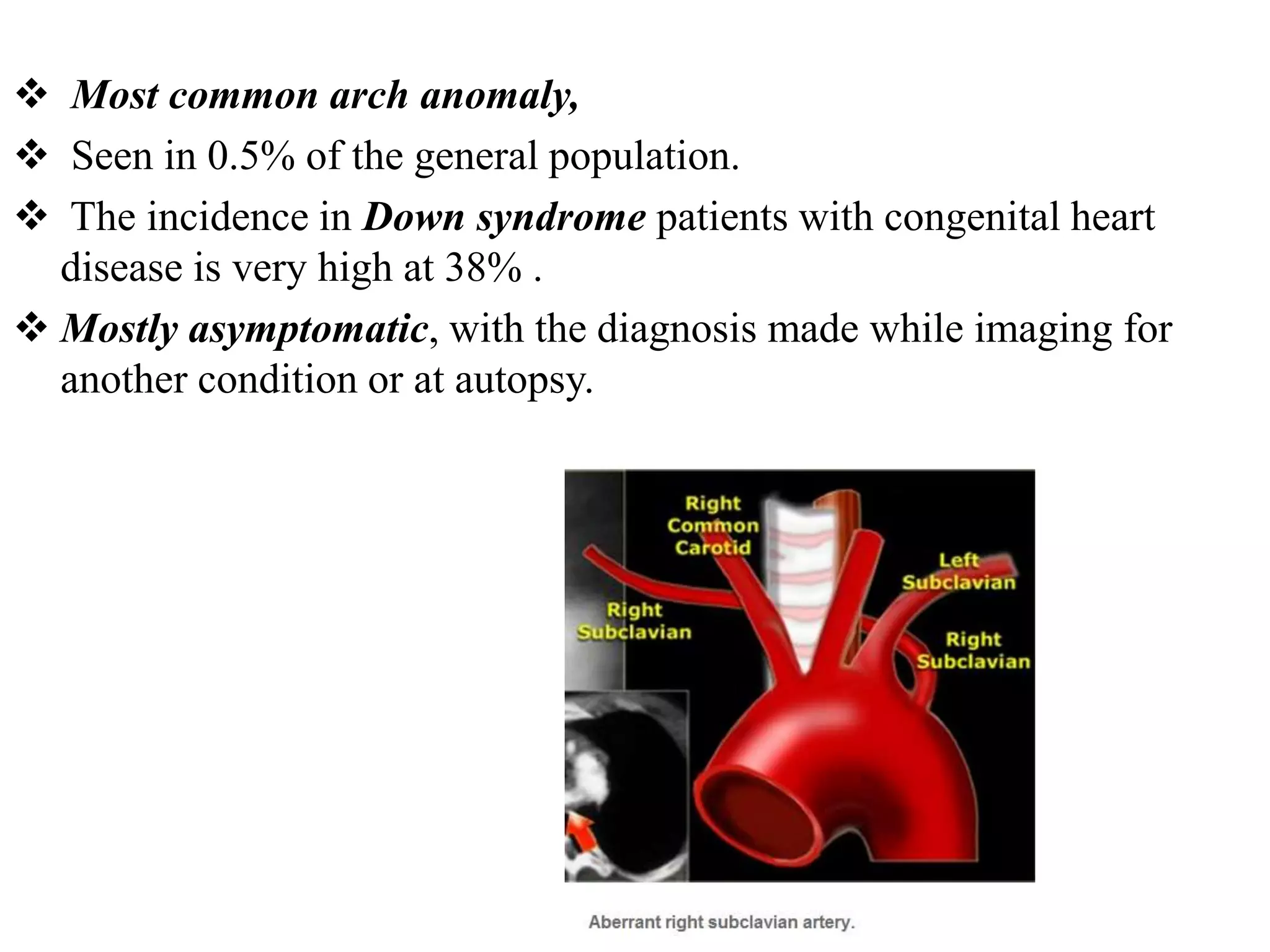 aortic arch anamolies | PPTX