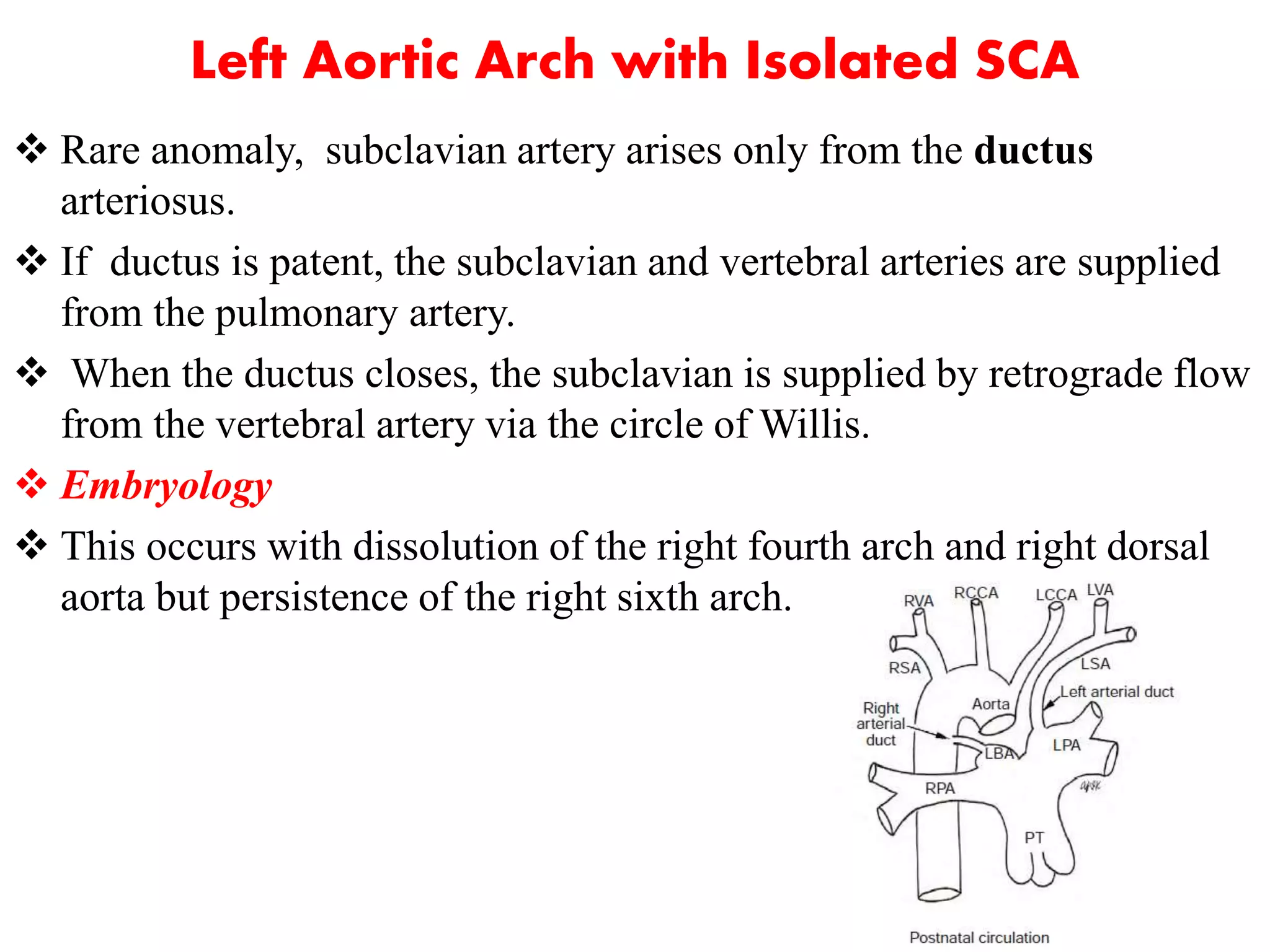 aortic arch anamolies | PPTX