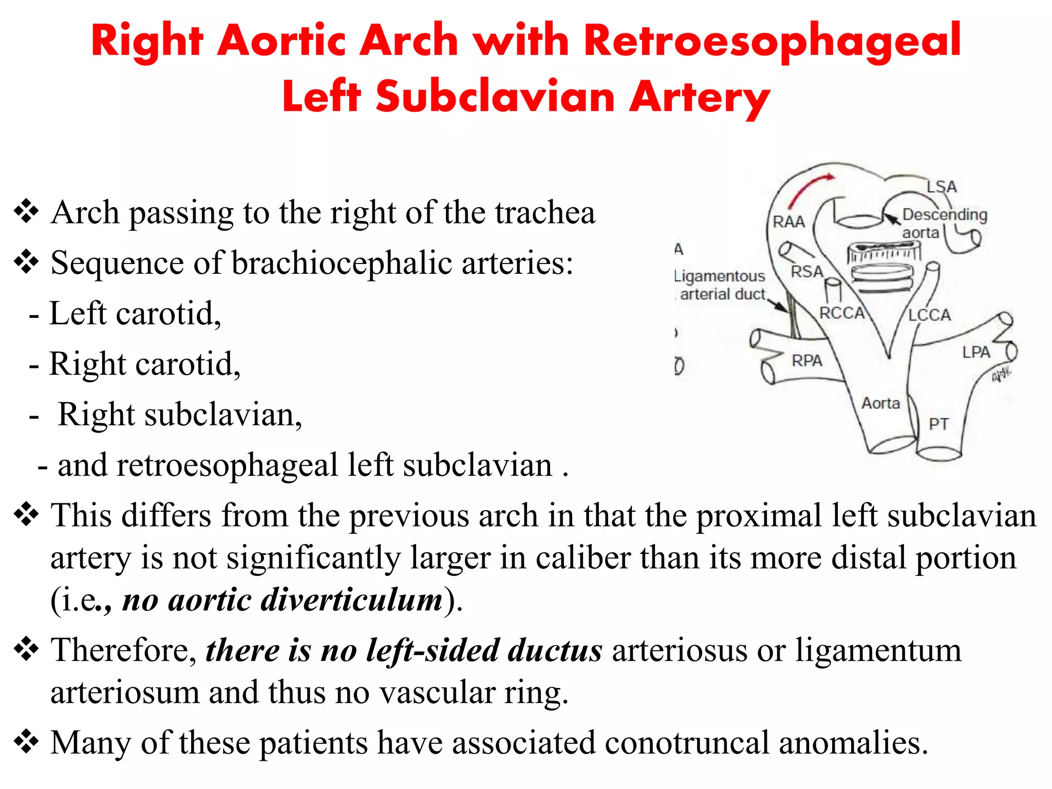 aortic arch anamolies | PPTX