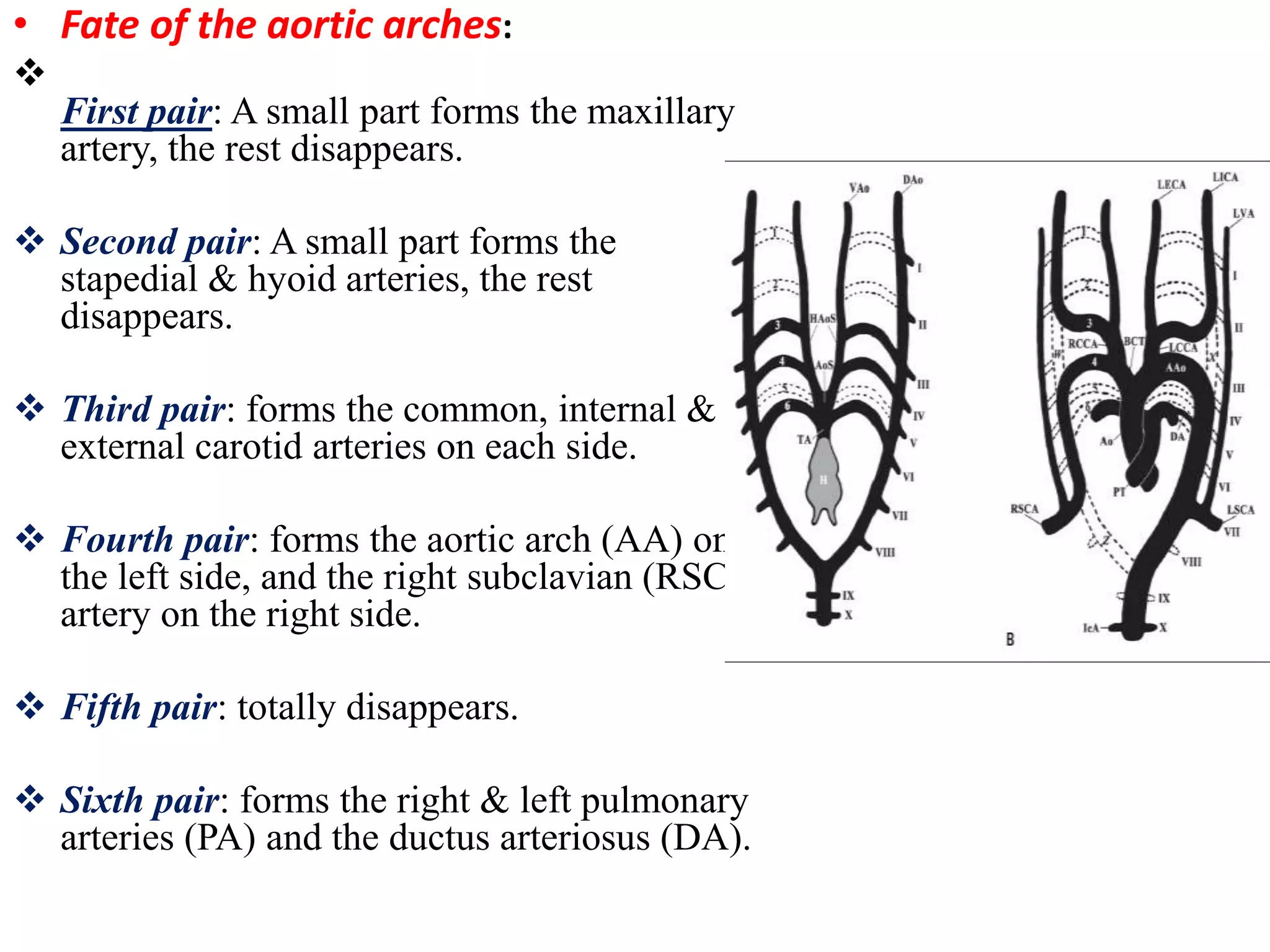 aortic arch anamolies | PPTX