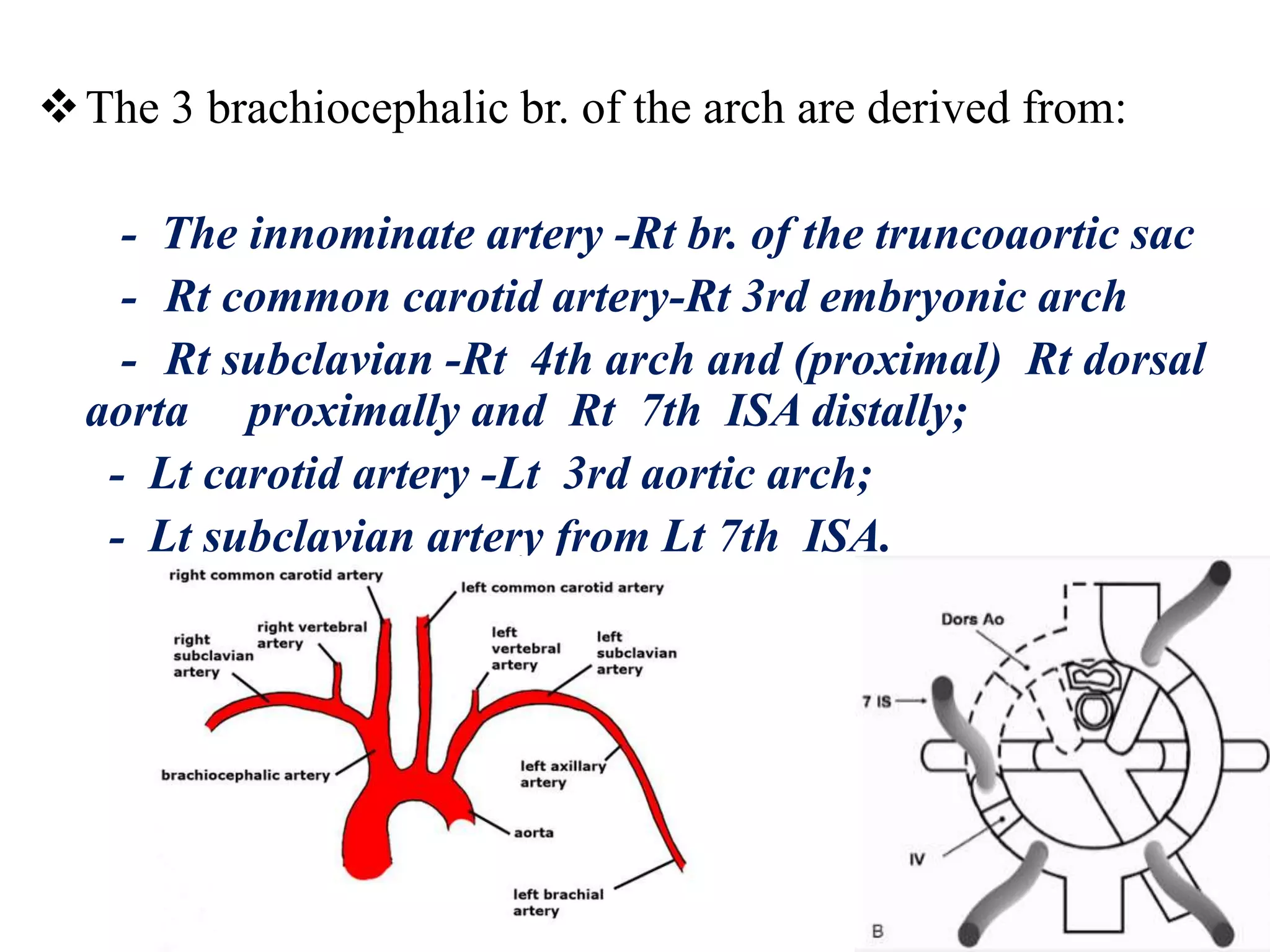 aortic arch anamolies | PPTX