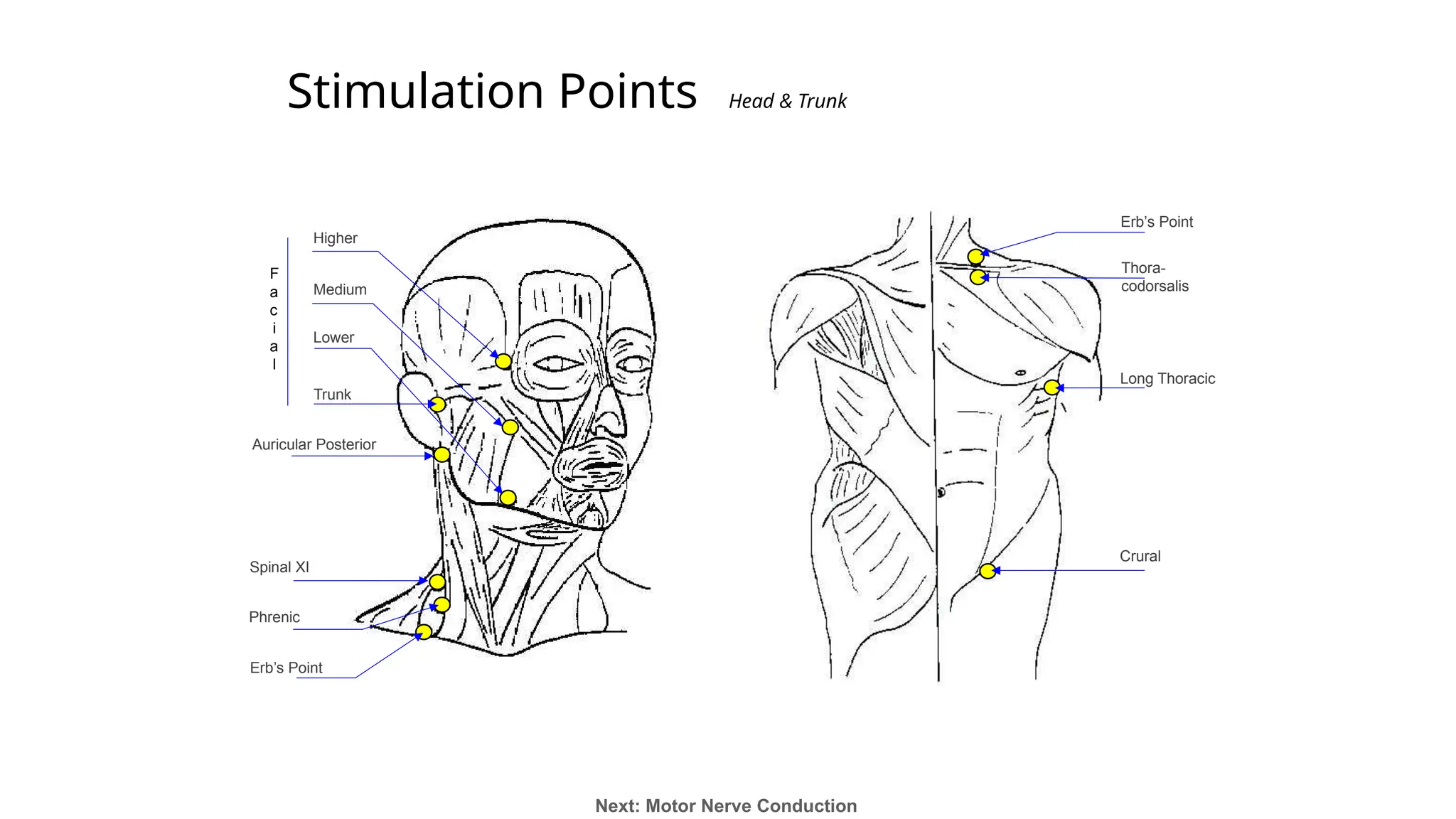 WORKSHOP EMG Electroneuromyography EP.pptx