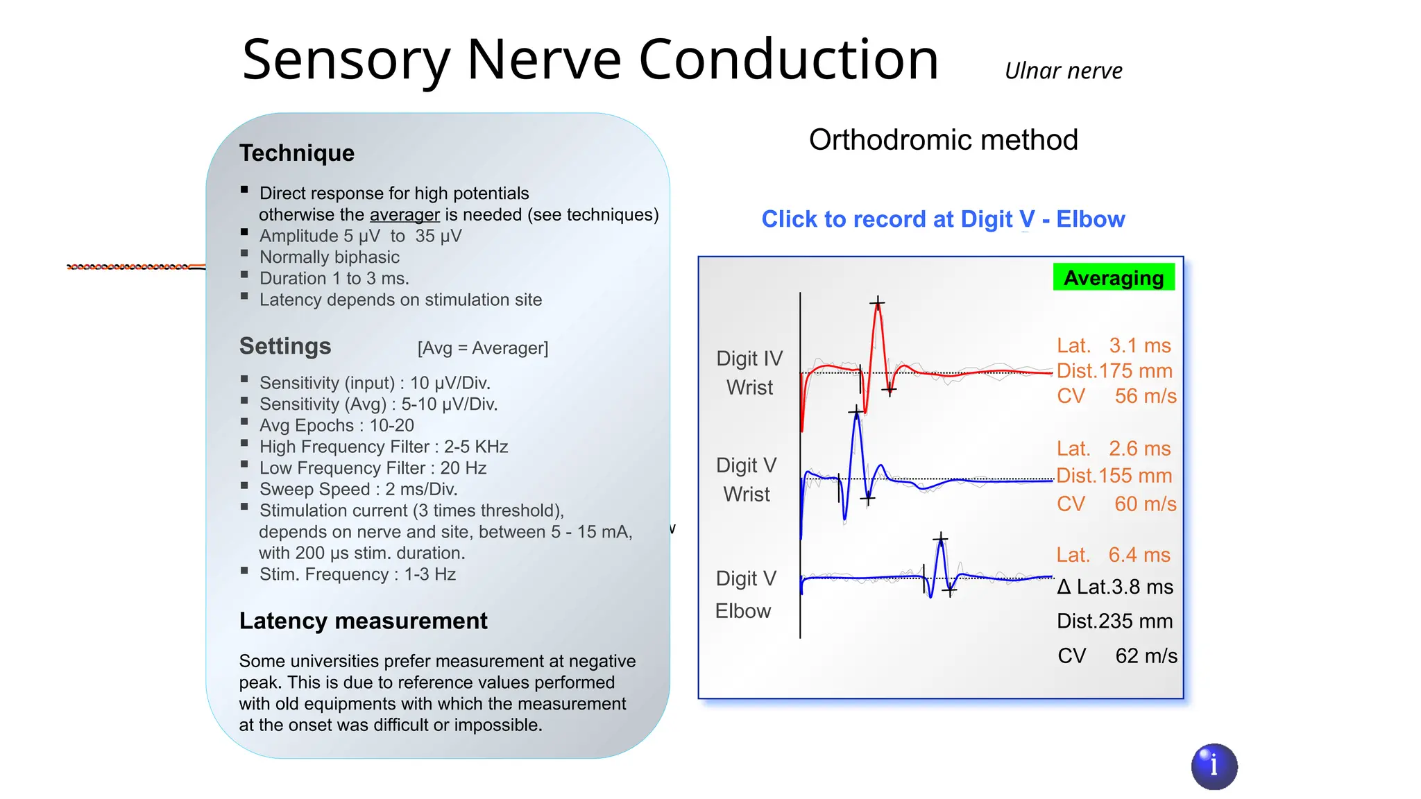 WORKSHOP EMG Electroneuromyography EP.pptx