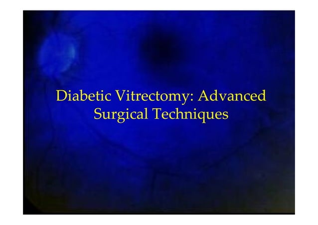 Aaberg jr surgical management for diabetic retinopathy 2014 | PDF | Eye ...