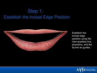 PRINCIPLES OF SMILE DESIGN-DEMYSTIFIED | PPTX