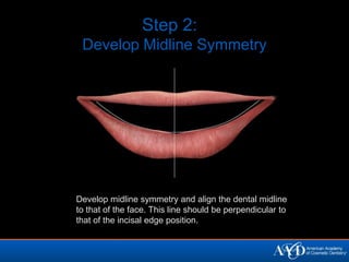 PRINCIPLES OF SMILE DESIGN-DEMYSTIFIED | PPTX