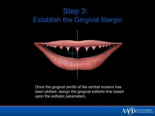 PRINCIPLES OF SMILE DESIGN-DEMYSTIFIED | PPTX
