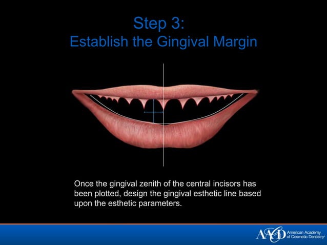 PRINCIPLES OF SMILE DESIGN-DEMYSTIFIED | PPTX