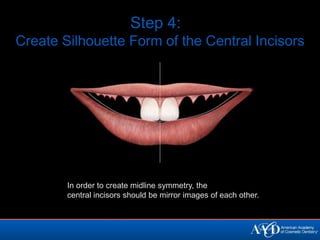 PRINCIPLES OF SMILE DESIGN-DEMYSTIFIED | PPTX