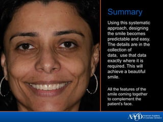 PRINCIPLES OF SMILE DESIGN-DEMYSTIFIED | PPTX