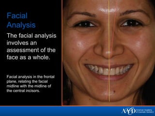 PRINCIPLES OF SMILE DESIGN-DEMYSTIFIED | PPTX