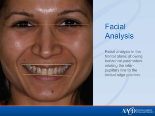 PRINCIPLES OF SMILE DESIGN-DEMYSTIFIED | PPTX