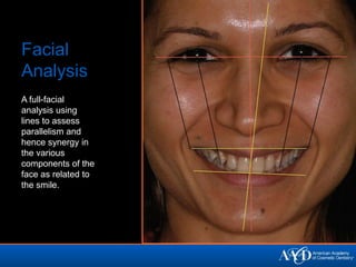 PRINCIPLES OF SMILE DESIGN-DEMYSTIFIED | PPTX