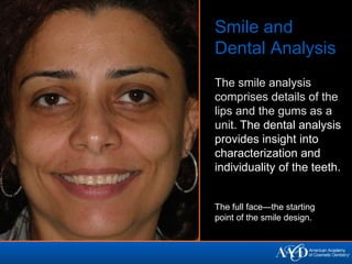 PRINCIPLES OF SMILE DESIGN-DEMYSTIFIED | PPTX