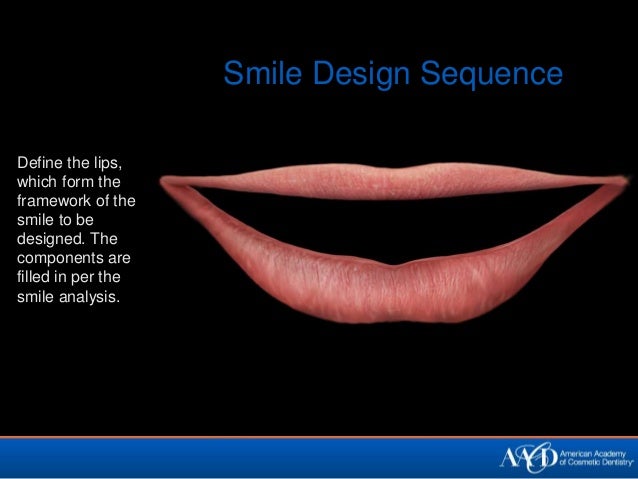 PRINCIPLES OF SMILE DESIGN-DEMYSTIFIED