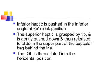 Optical rehabilitation or Correction of Aphakia | PPT | Eye and Vision ...