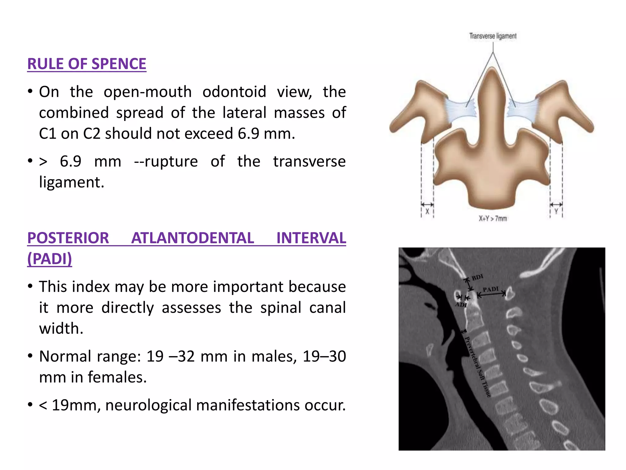 Imaging Cervico-vertebral junction: AAD with BI .pptx