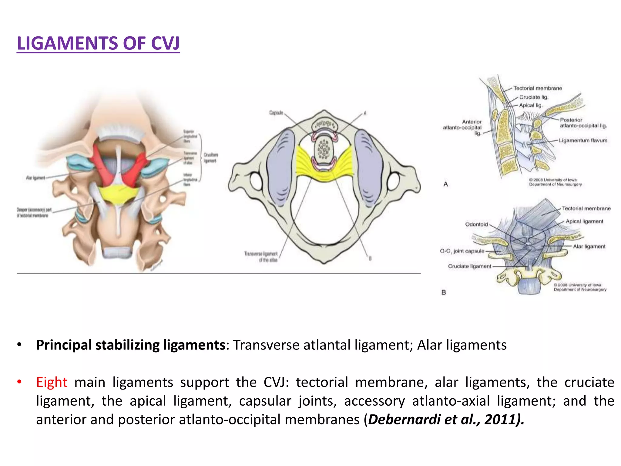 Imaging Cervico-vertebral junction: AAD with BI .pptx