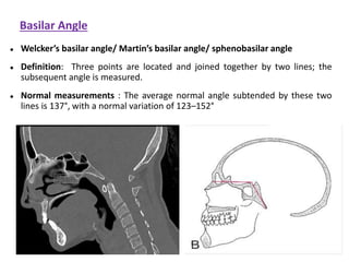 Imaging Cervico-vertebral junction: AAD with BI .pptx