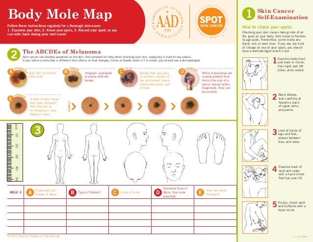 American Academy of Dermatology's Body Mole Map
