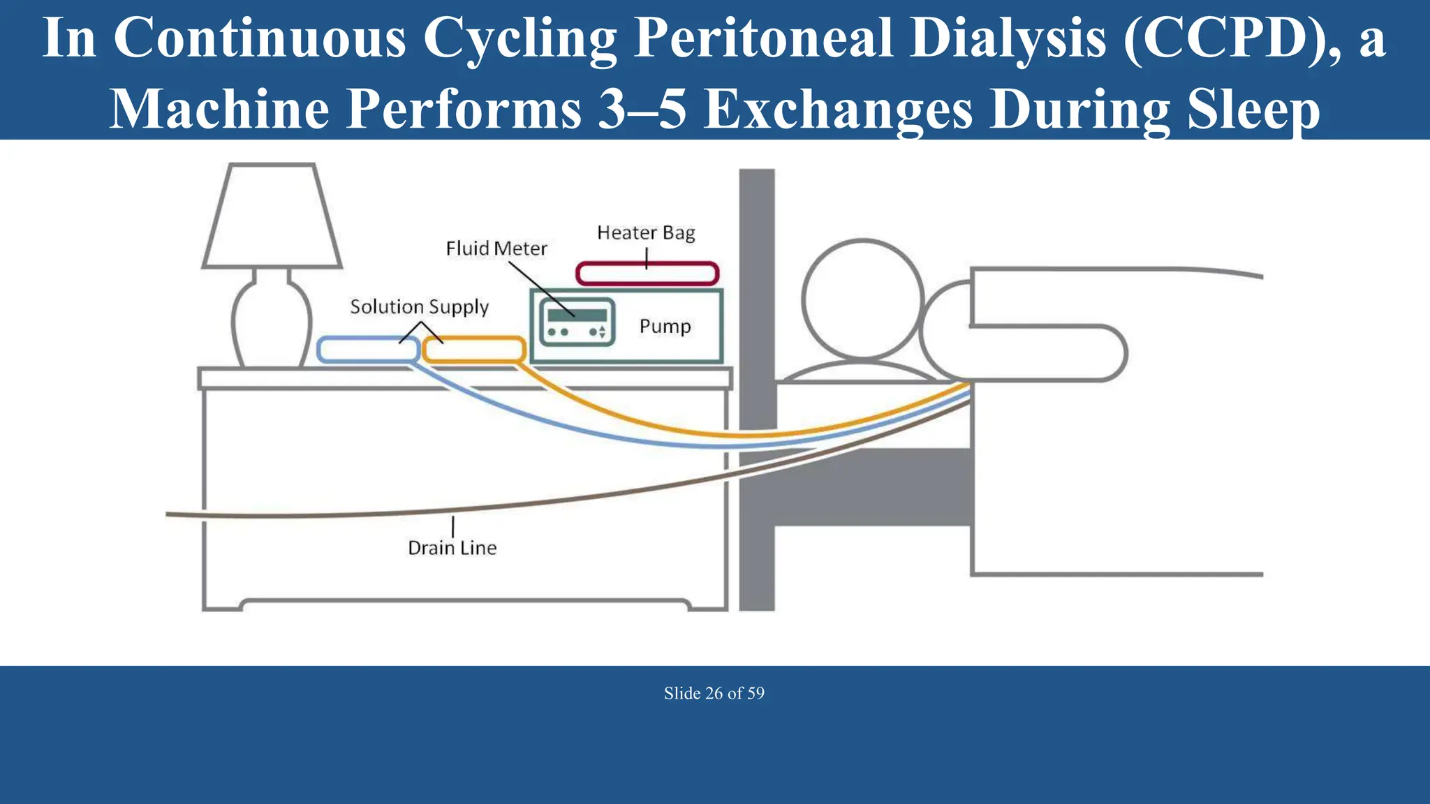 Kidney Failure Treatment, Patient Education, and Course Summary | PPT ...
