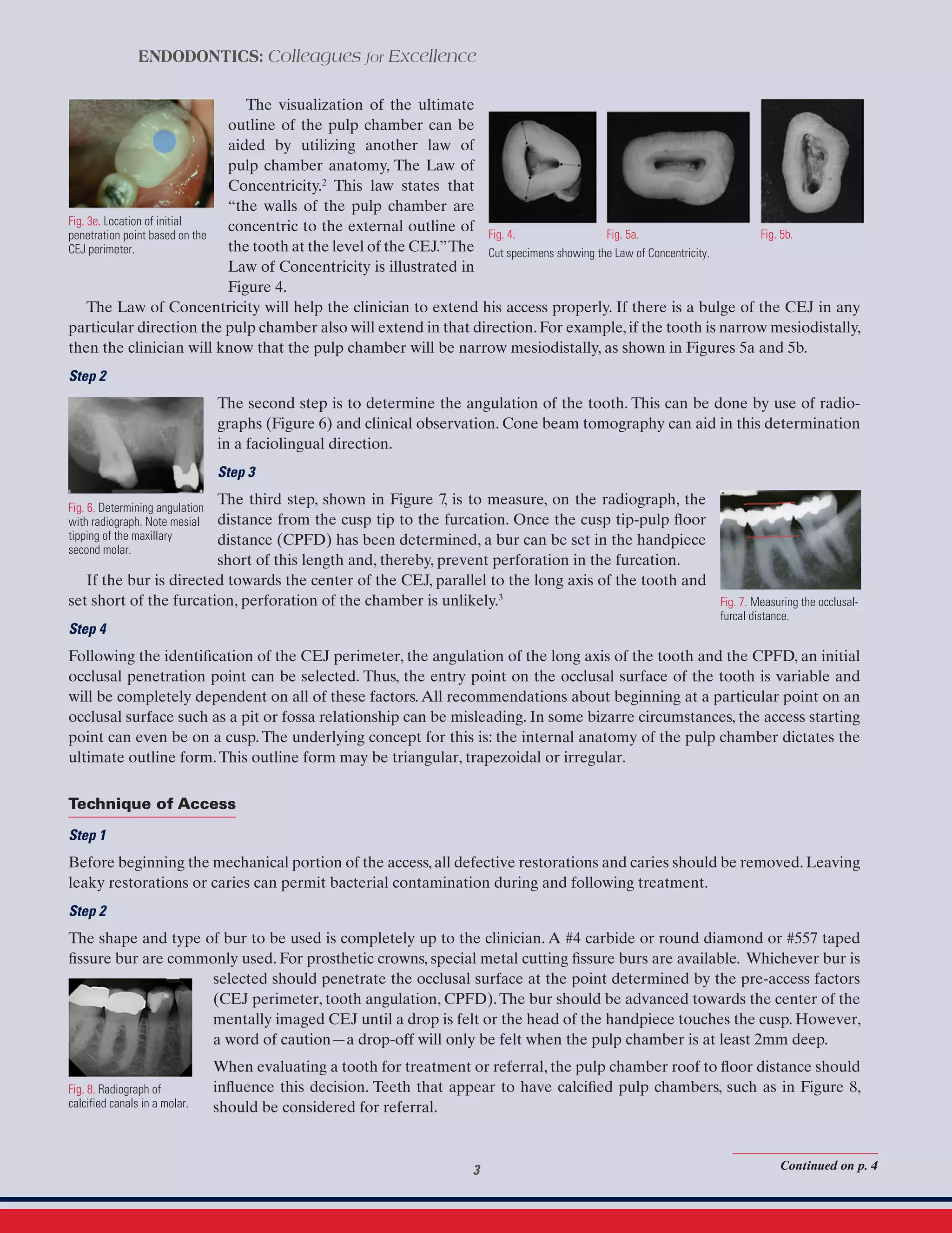 Endodontic Access Opening and Canal Location | PDF