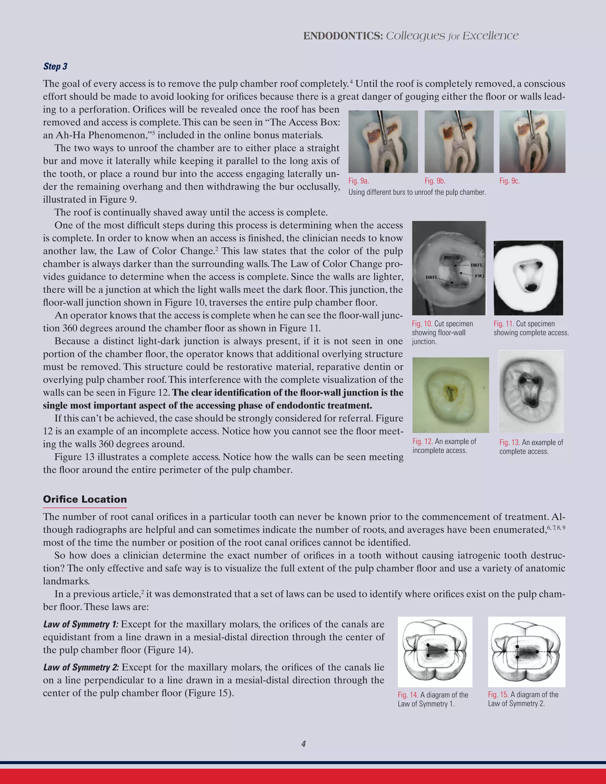 Endodontic Access Opening and Canal Location | PDF