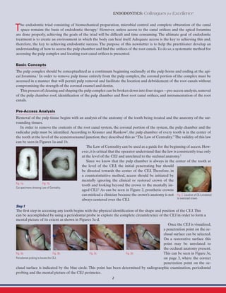 Endodontic Access Opening and Canal Location | PDF