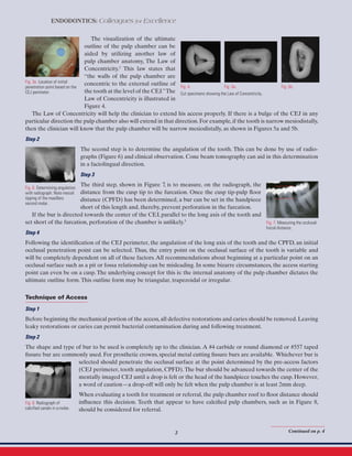 Endodontic Access Opening and Canal Location | PDF