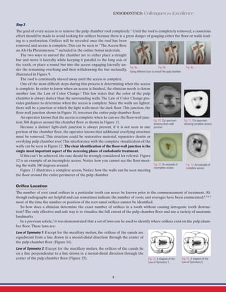 Endodontic Access Opening and Canal Location | PDF