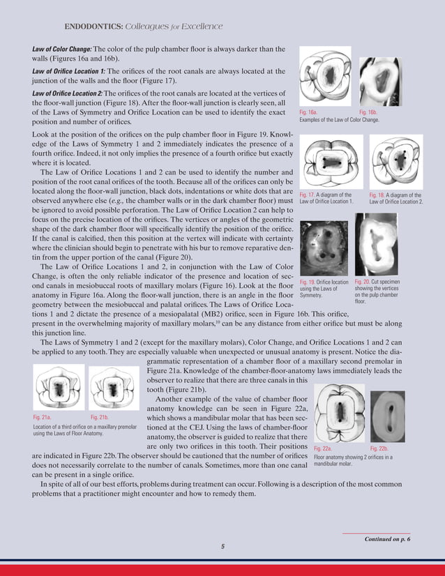 Endodontic Access Opening and Canal Location | PDF