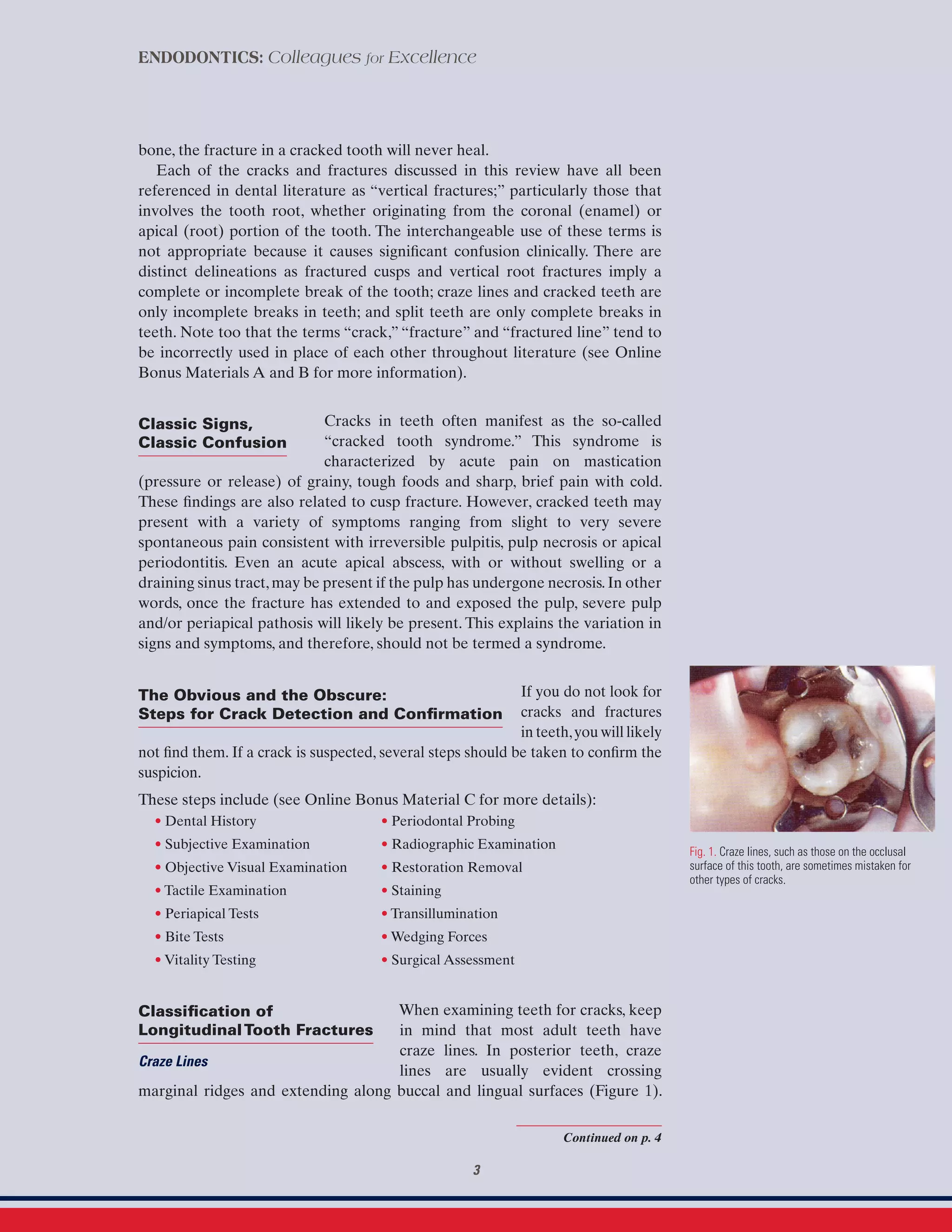 Cracked Teeth : management of longitudinal fractures | PDF